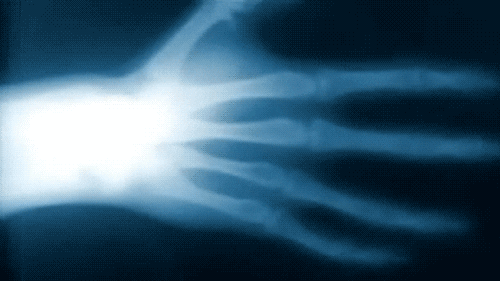 Xray Animated GIF