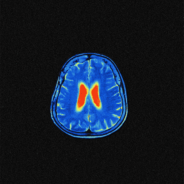 Neuroscientists GIFs - Get the best GIF on GIPHY