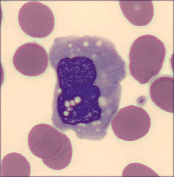 Vacuoles GIFs - Get the best GIF on GIPHY