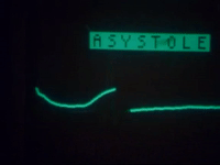 Hospital Heart Rate Monitor Gif