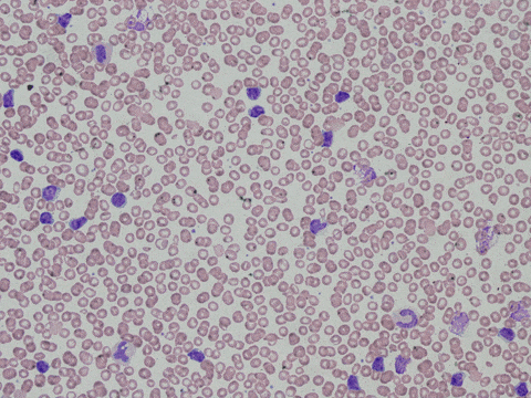 White Blood Cells GIFs - Get the best GIF on GIPHY