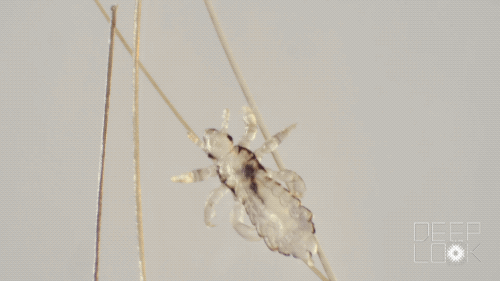 Hair Lice GIF by PBS Digital Studios - Find & Share on GIPHY
