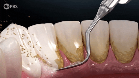 Teeth Dentist GIF by PBS Digital Studios - Find & Share on GIPHY