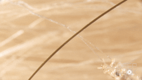 Hair Lice GIF by PBS Digital Studios - Find & Share on GIPHY