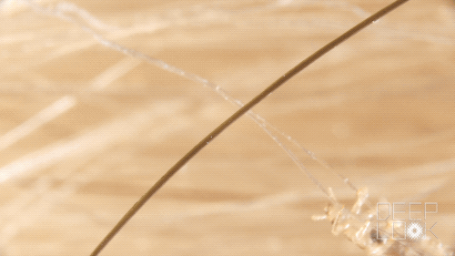 Hair Lice GIF by PBS Digital Studios - Find & Share on GIPHY