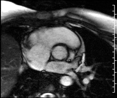 Mri GIFs - Find & Share on GIPHY