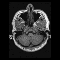 Mri GIFs - Find & Share on GIPHY