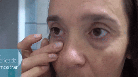 Under Eye Wrinkles GIFs - Get the best GIF on GIPHY