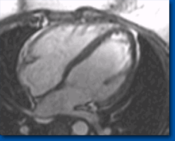 Cardiovascular GIFs - Find & Share on GIPHY