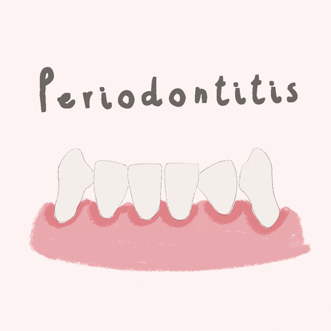 Periodontitis GIFs - Get the best GIF on GIPHY